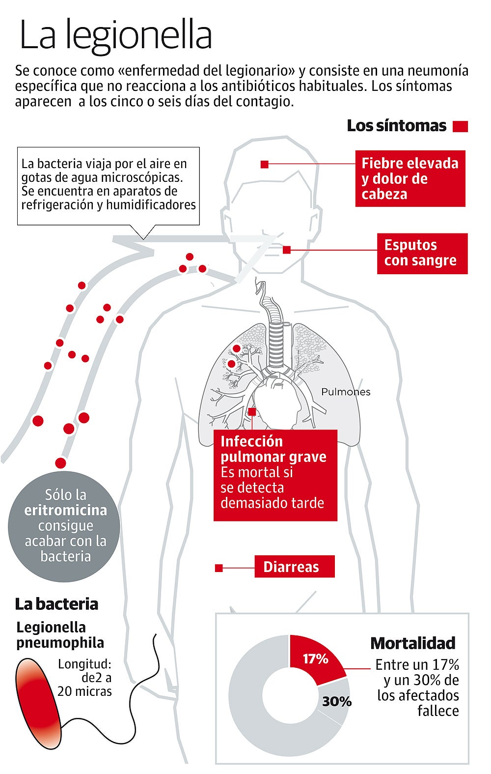 Detectado «un caso aislado» de legionelosis en una mujer de 71 años ...